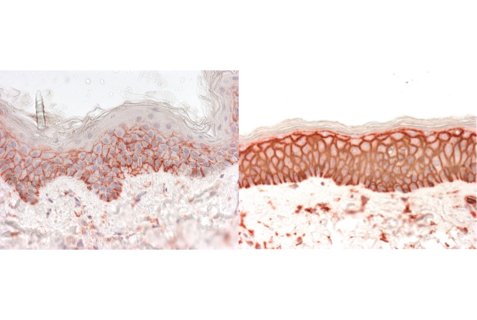 HyaluB5 Serum:Αντιρυτιδικός Ορός Προσώπου με Υαλουρονικό Οξύ